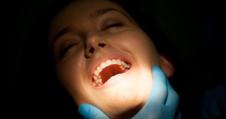Tartru dentar (piatra): de ce apare și cum scăpăm de el